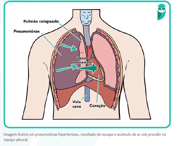 Trauma: avaliação, vias aéreas e muito mais! - Estratégia MED