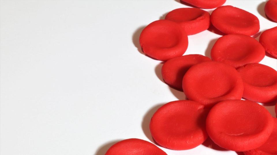 ResuMED de Anemias microcíticas - tipos de anemia e seus diagnósticos