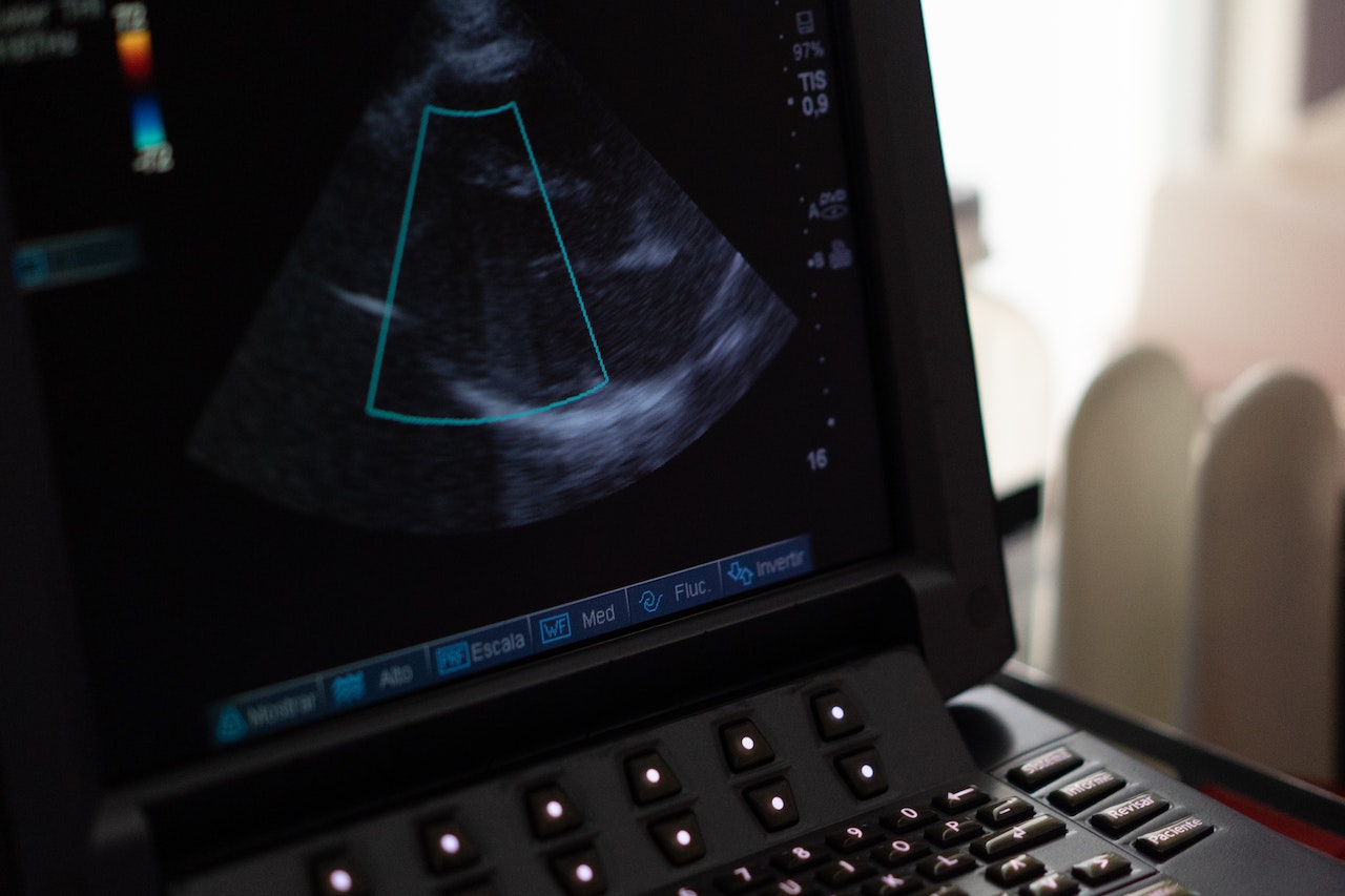 Resumo de ecocardiograma: indicações, técnica e muito mais!