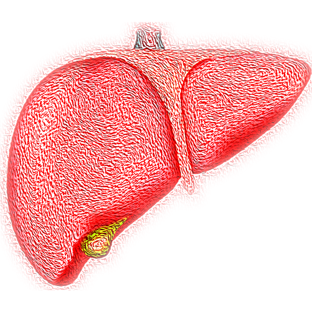 Resumo de esteatose hepática não alcoólica: diagnóstico, tratamento e mais!