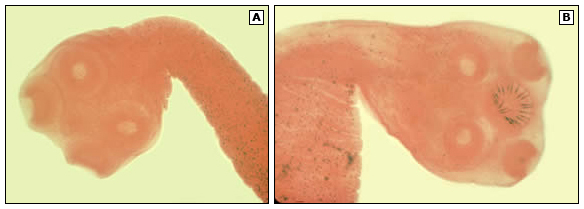 Resumo de Teníase: quadro clínico, tratamento e mais!