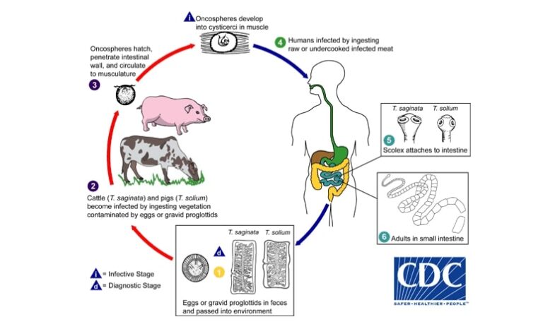 Resumo de Teníase: quadro clínico, tratamento e mais!