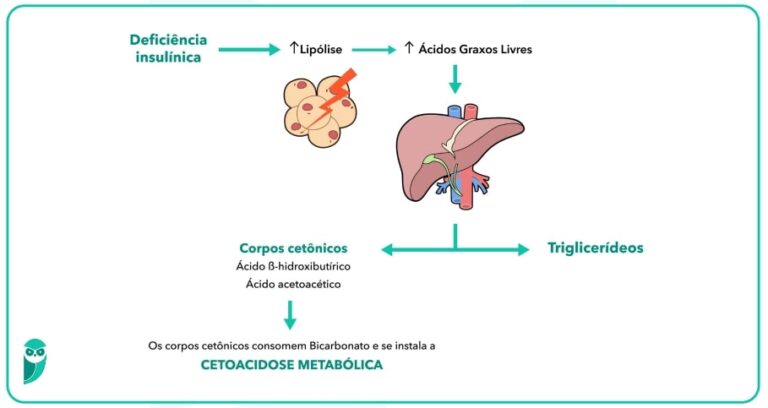 Resumo de Cetoacidose Diabética: causas, quadro clínico e mais!