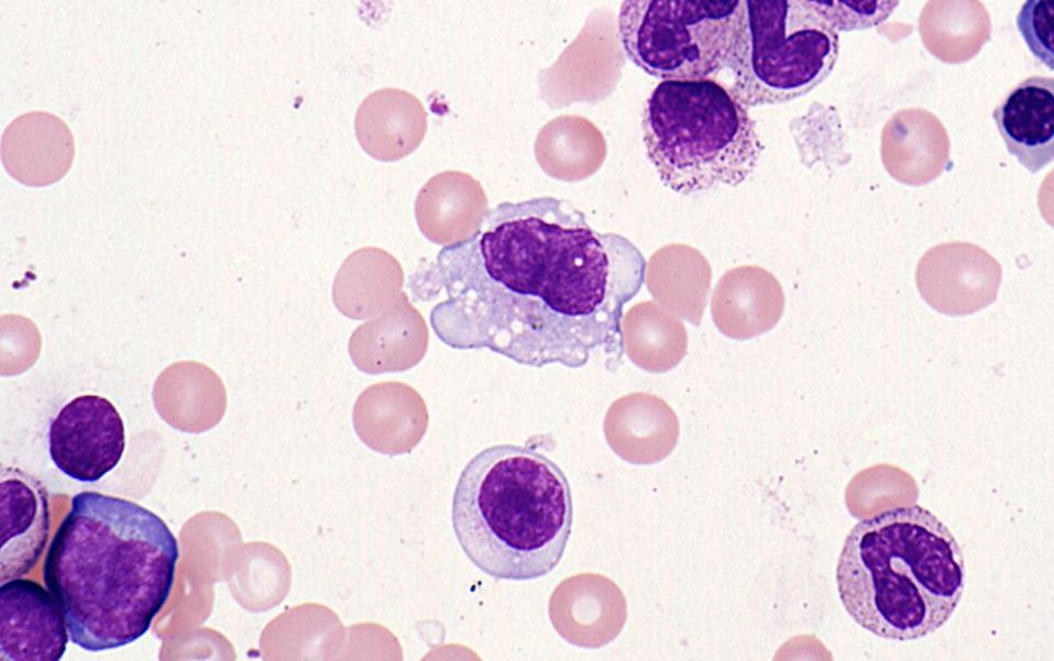 Resumo de Macrófagos: conceito, função e muito mais!