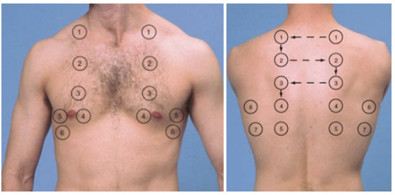 Resumo de Ausculta Pulmonar: técnica, sons e muito mais!
